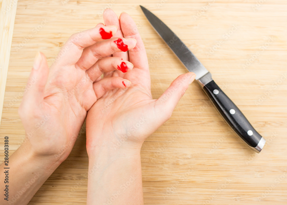 Kitchen Knife Injury