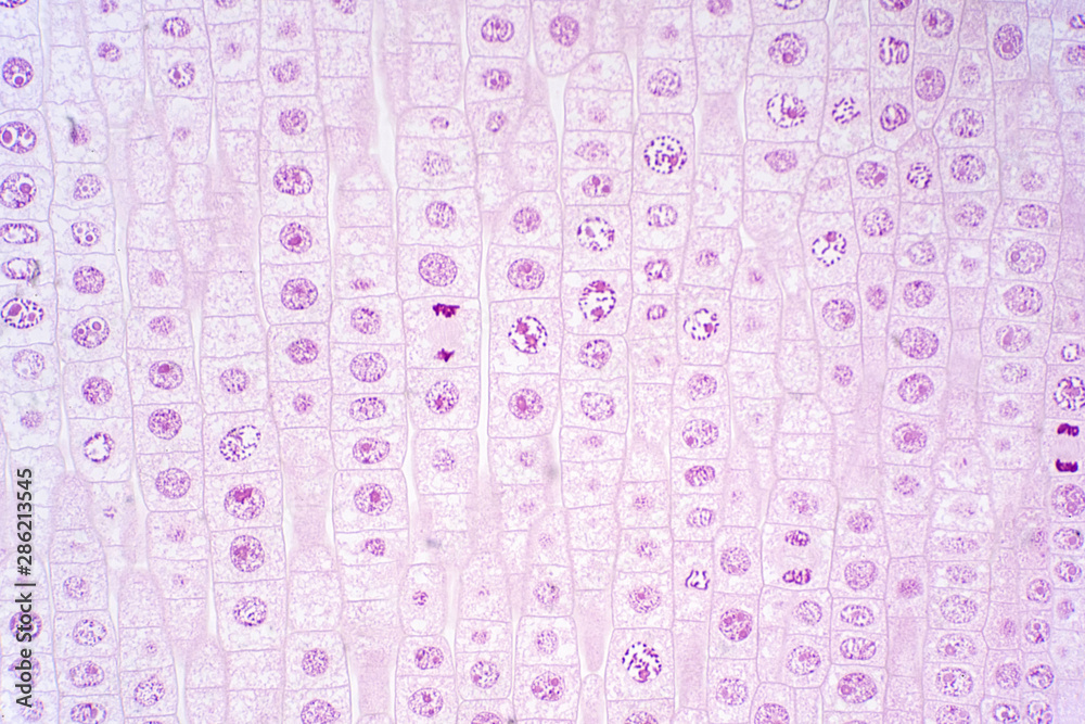 Foto de Root tip of Onion show Mitosis cell in the Root tip under ...