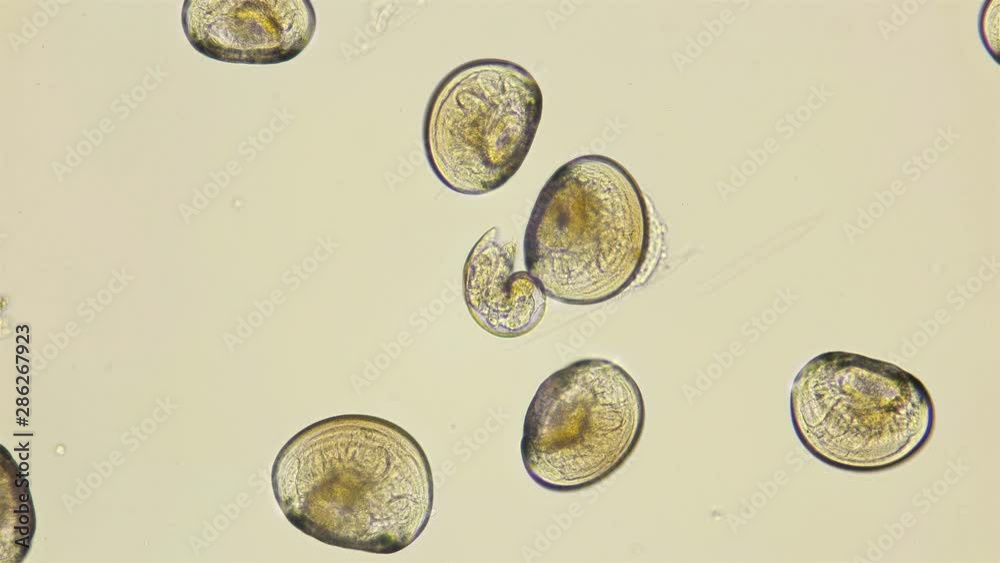 Black Sea plankton and zooplankton under a microscope, larvae of ...