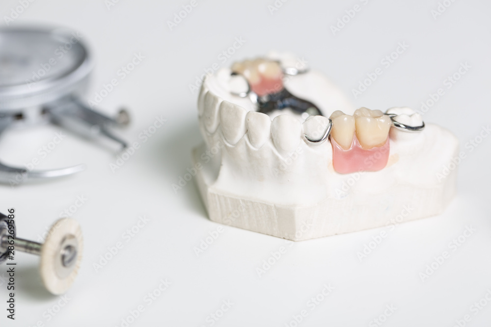 Dental imprint with artificial dentition in a dental laboratory Stock ... Dental imprint with artificial dentition in a dental laboratory Stock ...