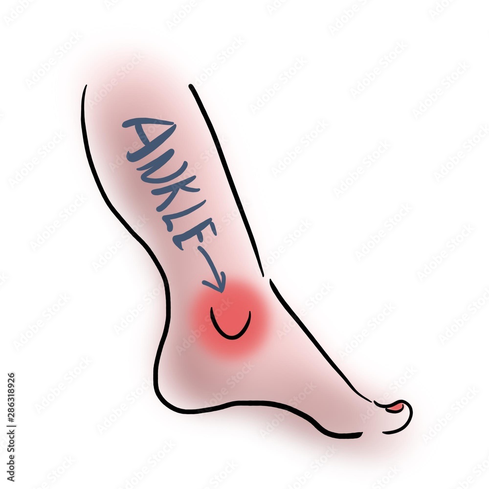 Ankle is located at the junction of the leg and the foot Stock ...