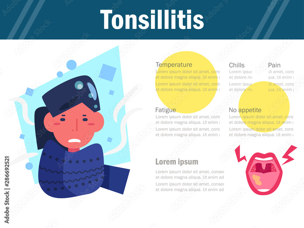 Tonsillitis Vector. Cartoon. Isolated art on white background. Flat ...