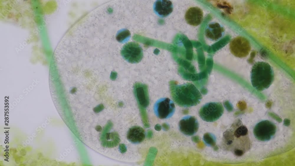 Frontonia sp. is a genus of free-living unicellular ciliate protists ...