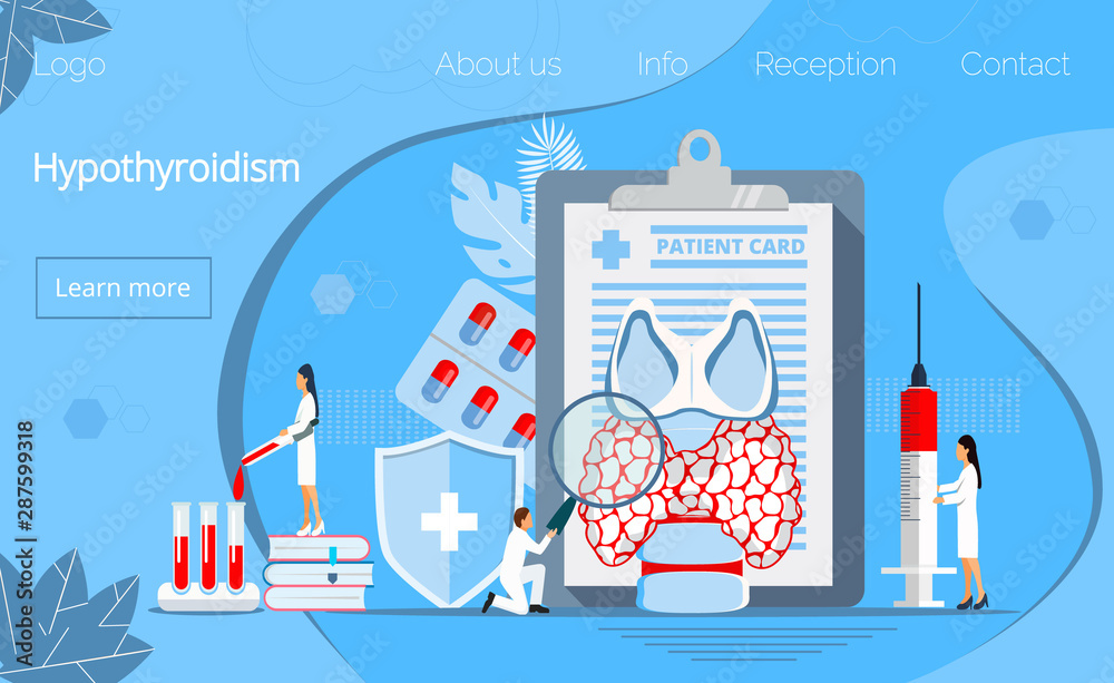 Hypothyroidism concept vector. Endocrinologists diagnose and treat ...