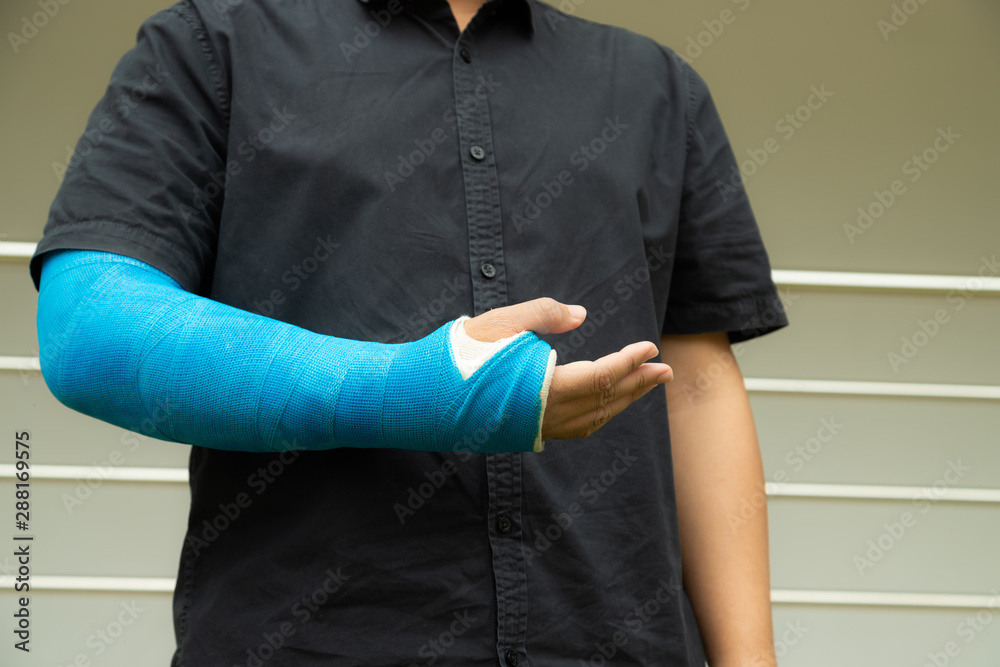 Asian men wear cloth splints on their arms to treat accident injuries ...
