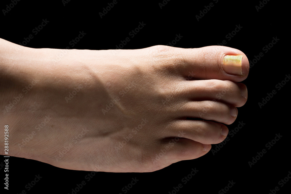 A close up and top view of a bare caucasian human foot, isolated ...