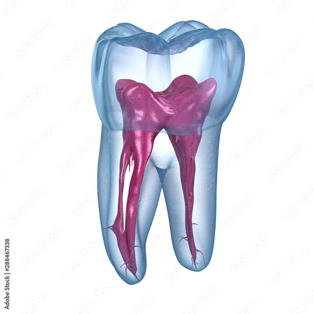 Maxillary Root Anatomy The Number Of Roots And Canals In The Maxillary