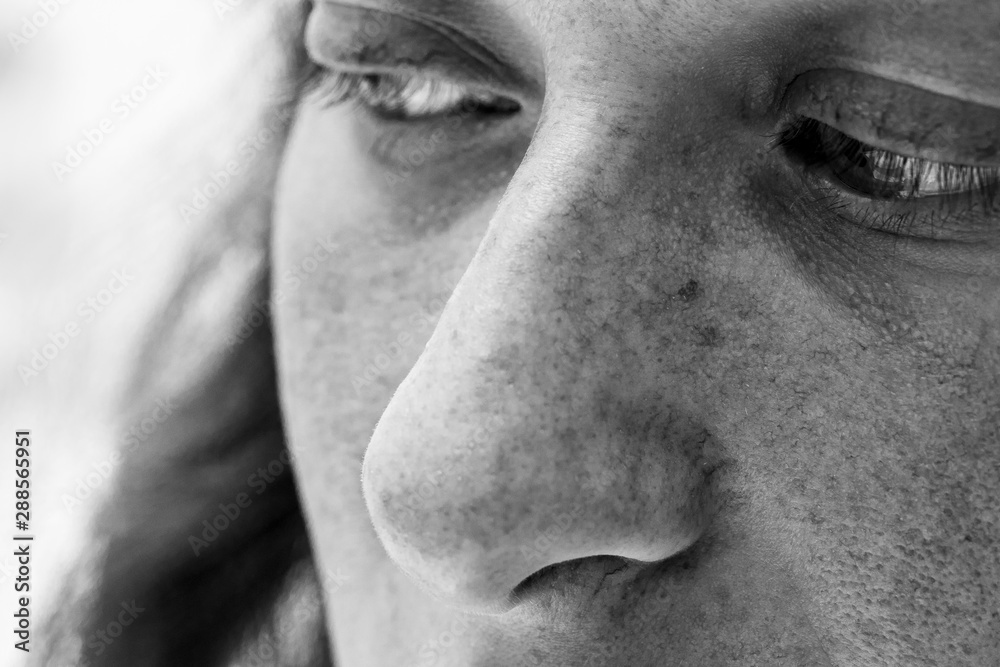 A monochrome portrait showing UV damage on the face of a pretty ...