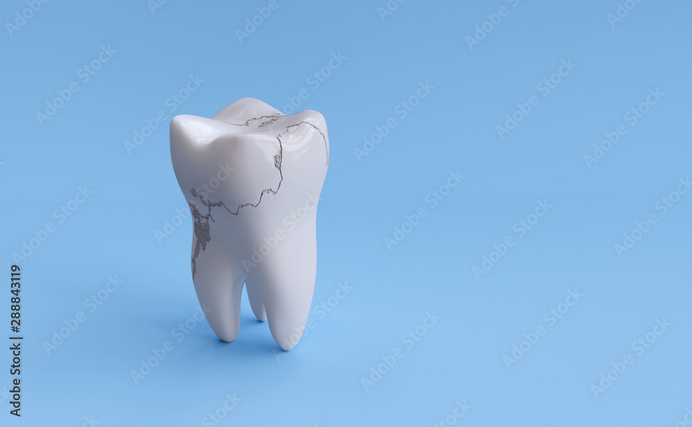 Broken tooth isolated on blue background with clipping path. 3d render ...
