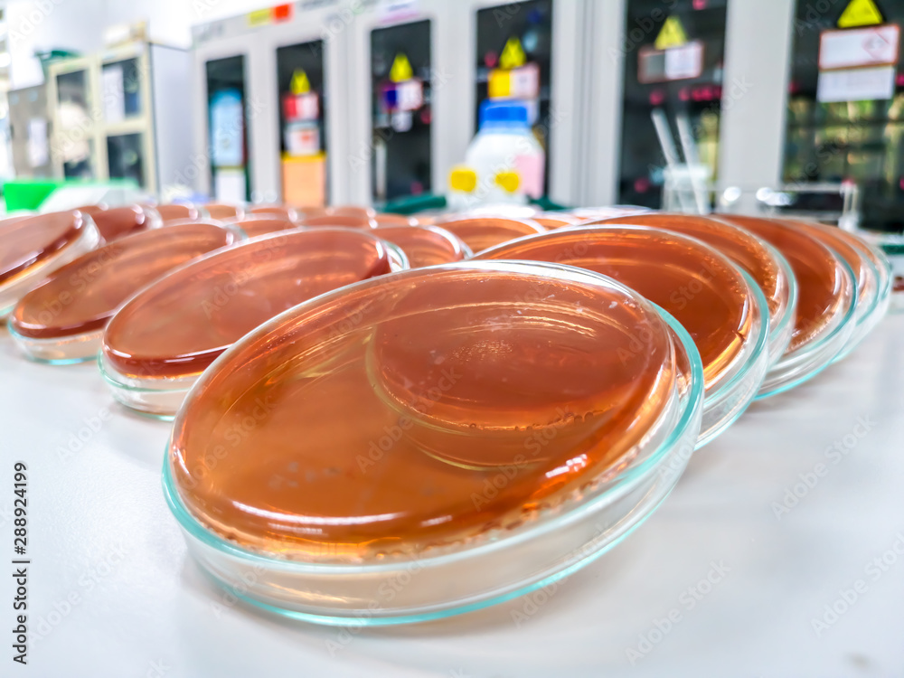 Salmonella Ss Agar