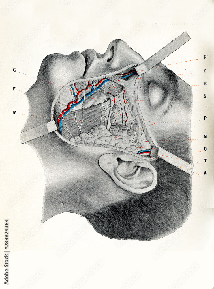 Surgery and medicine - cheek region: suborbital, preauricolar and ...