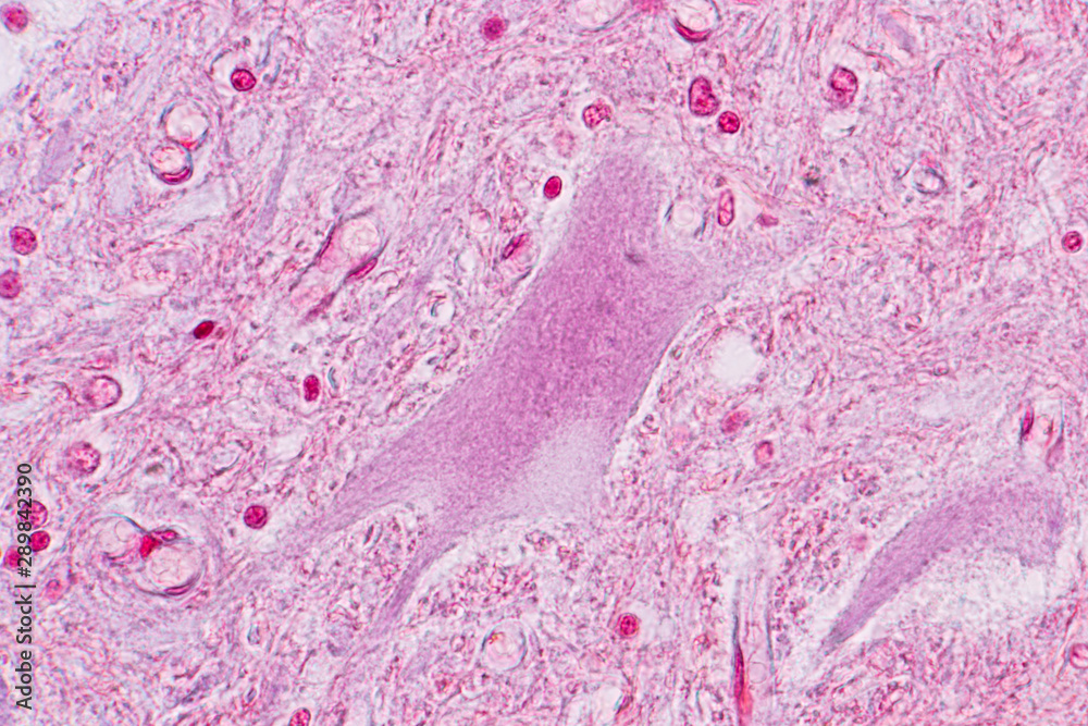 Nerve human under the microscope for education in Lab. Stock Photo ...