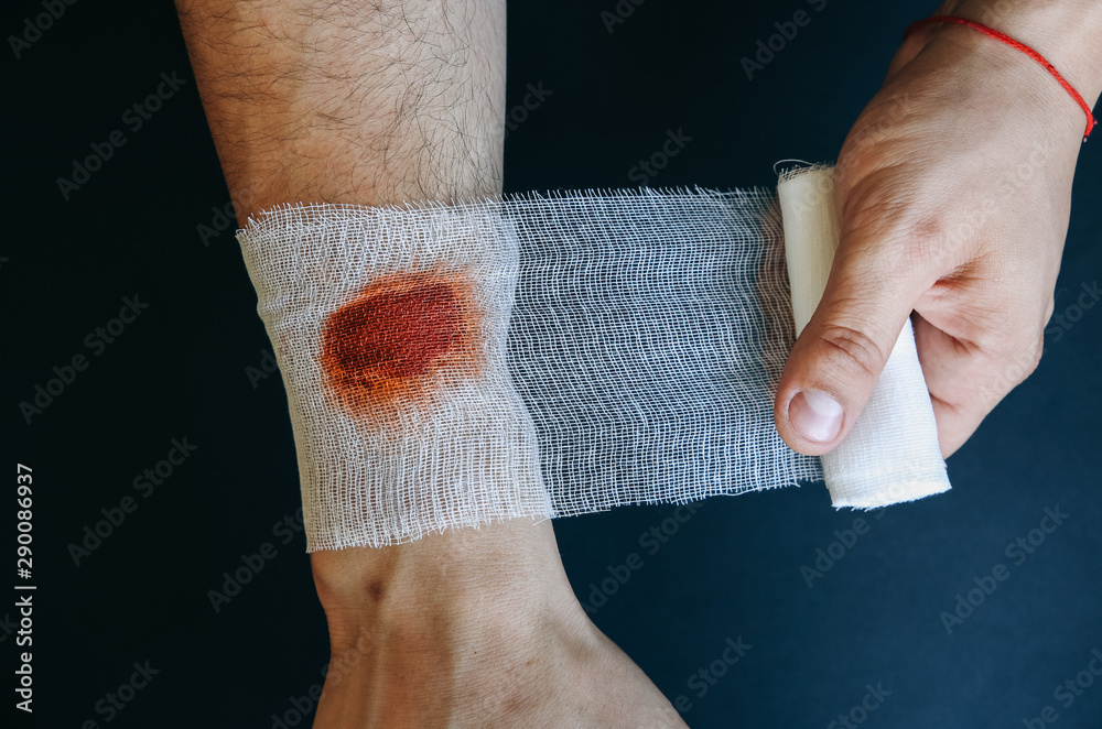 Man is putting the bandage on the wound. Bleeding injury. Stock Photo ...