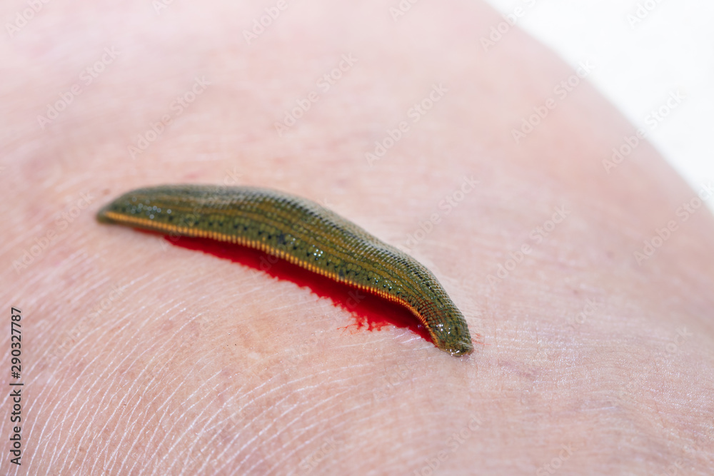 Leeches On Skin