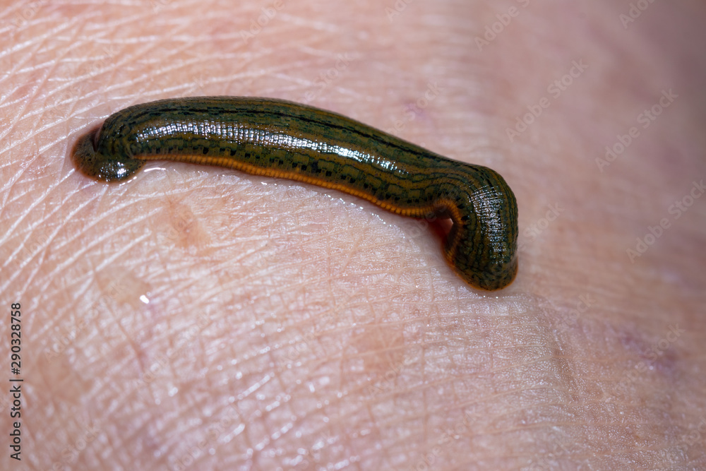 Foto de Aquatic Leech sucking blood on skin,Leeches were used in ...