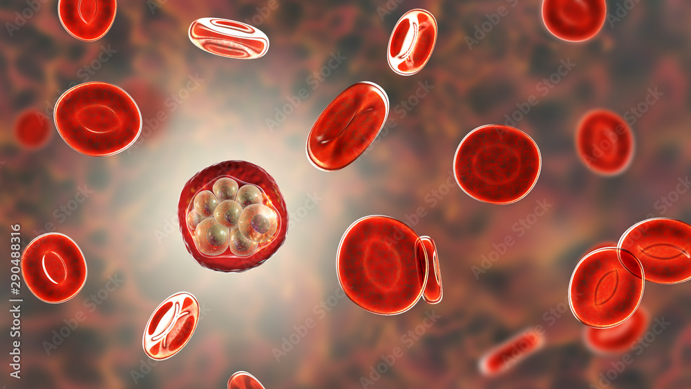 Red blood cells infected with malaria parasite, 3D illustration showing ...