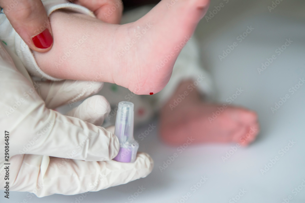 Poster nurse performing the neonatal heel prick test – Wall Art | UkPosters