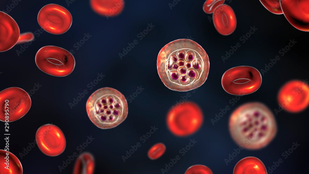 Red blood cells infected with malaria parasite Plasmodium vivax ...