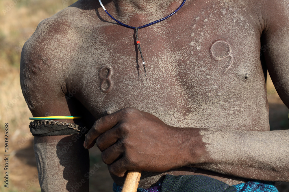 Scarification on upper body, Mursi tribe, Lower Omo Valley, Ethiopia ...