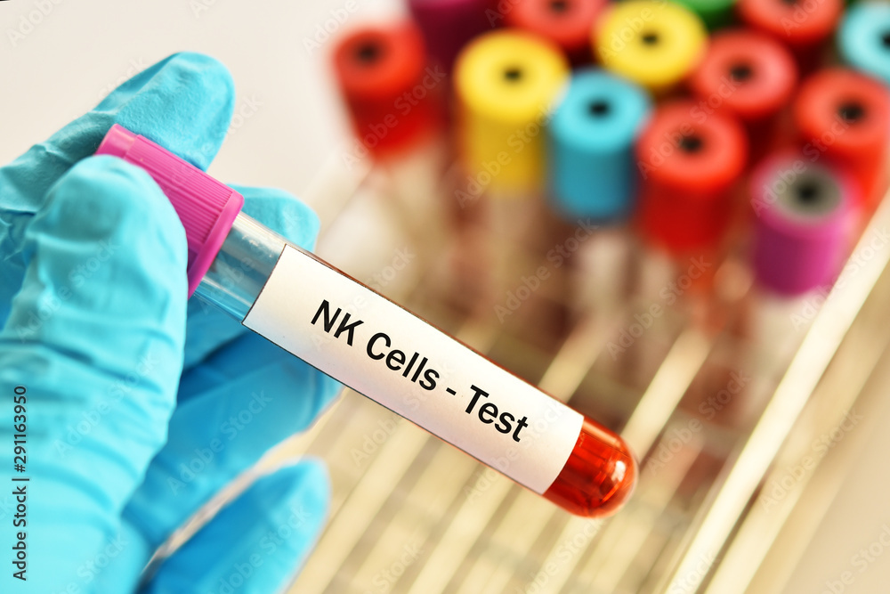 Blood sample tube for NK cells test Stock Photo | Adobe Stock