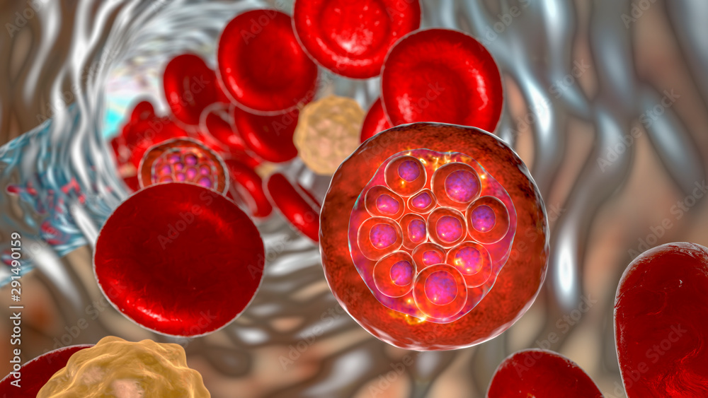 The malaria-infected red blood cells. 3D illustration showing malaria parasite Plasmodium vivax ...