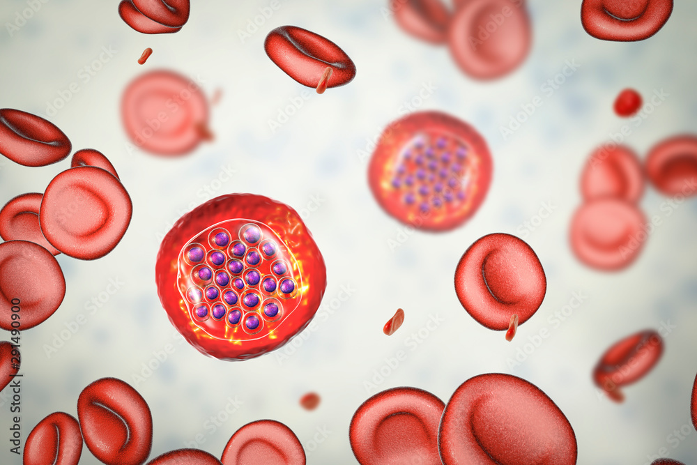 The malaria-infected red blood cells. 3D illustration showing malaria ...