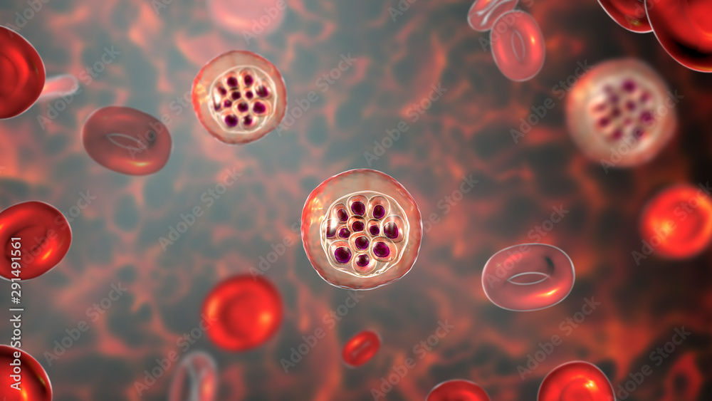 Red blood cells infected with malaria parasite Plasmodium vivax ...