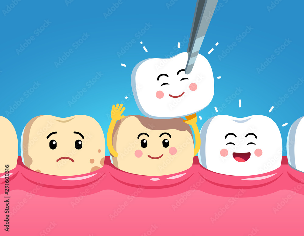 Funny cartoon teeth characters on gum and veneer Stock Vector | Adobe Stock
