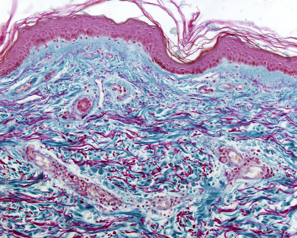 Elastic Fibers Collagen