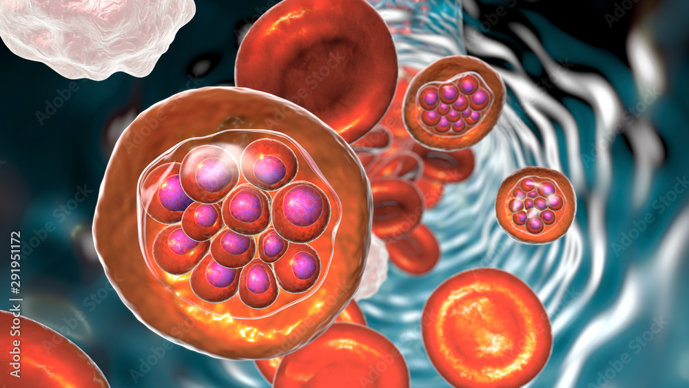 The malaria-infected red blood cells. 3D illustration showing malaria ...