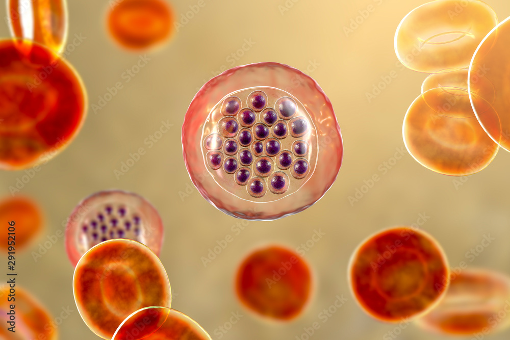 The malaria-infected red blood cells. 3D illustration showing malaria ...