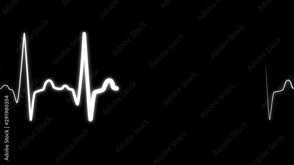 Electrocardiogram screen with heartbeat line. Medical monitor of heart ...