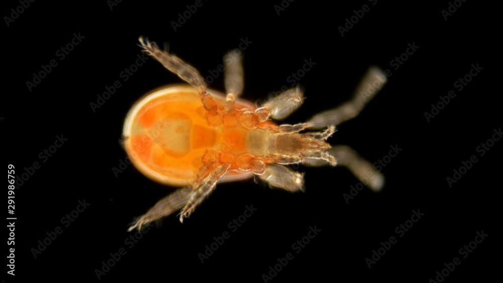 a tick of the order Mesostigmata under a microscope, class Arachnida ...