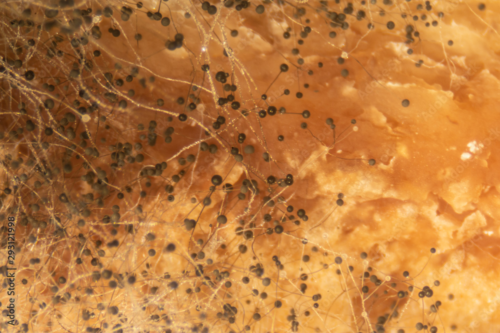 Rhizopus (bread mold) is a genus of common saprophytic fungi,Rhizopus ...