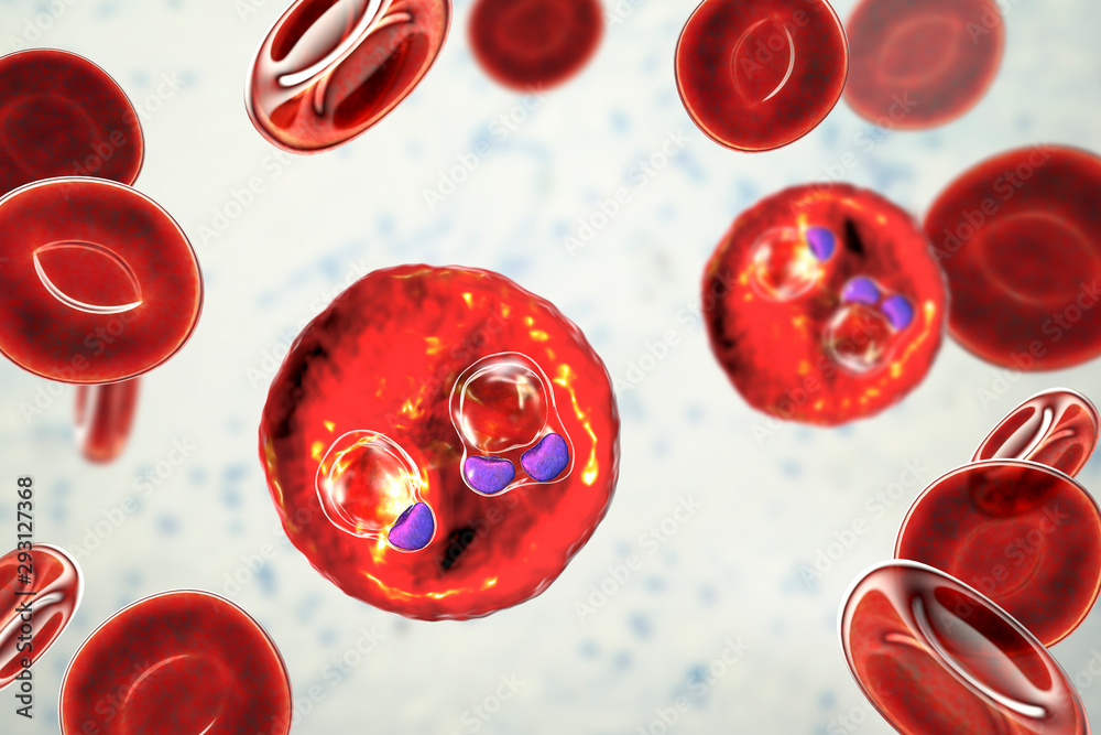 The malaria-infected red blood cells. 3D illustration showing ring-form ...