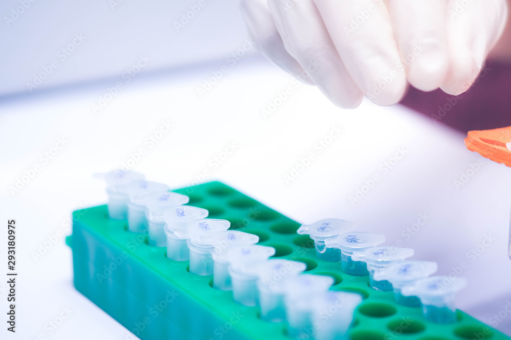 eppendorf tube on pastic rack in laboratory/ Scientific laboratory ...