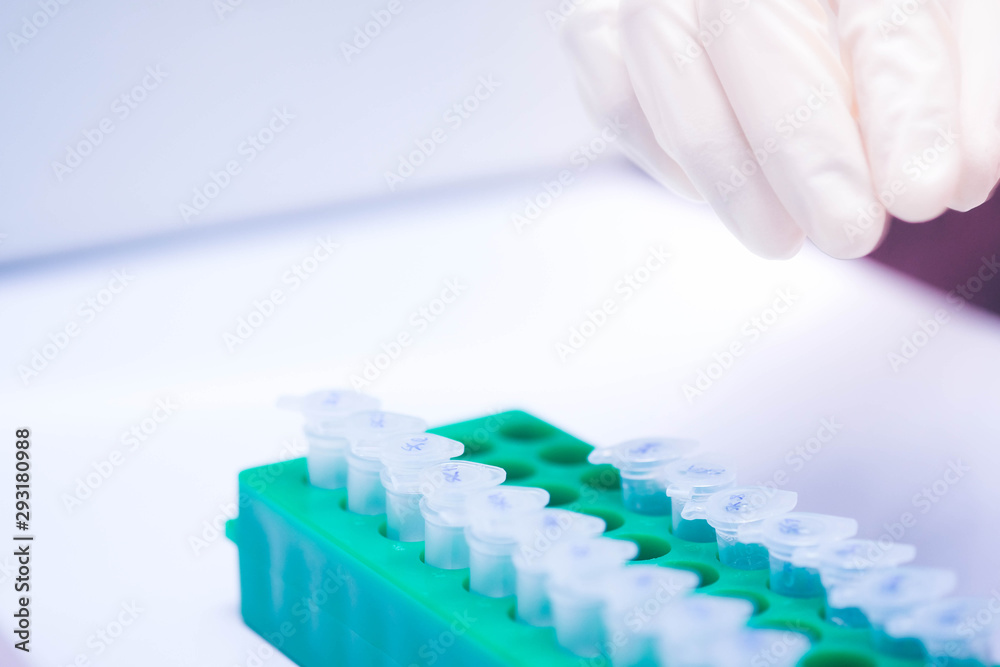 eppendorf tube on pastic rack in laboratory/ Scientific laboratory ...