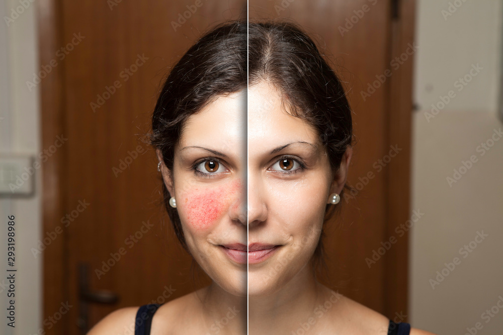 A confident young woman is seen showing the before and after results of ...
