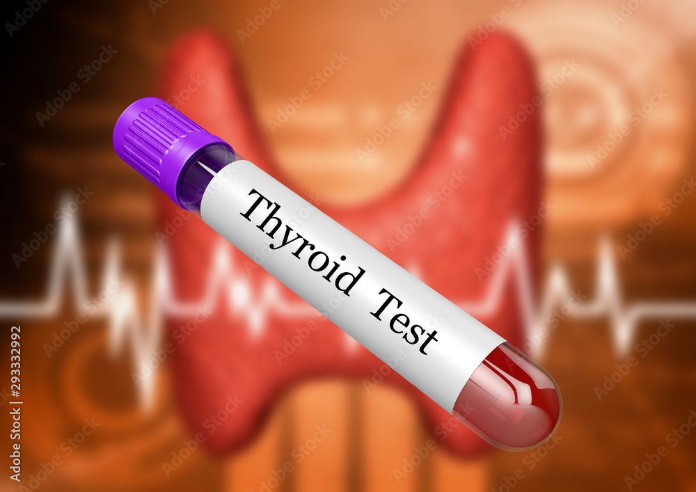 Blood sample in test tube for hormonal examination of thyroid gland in ...