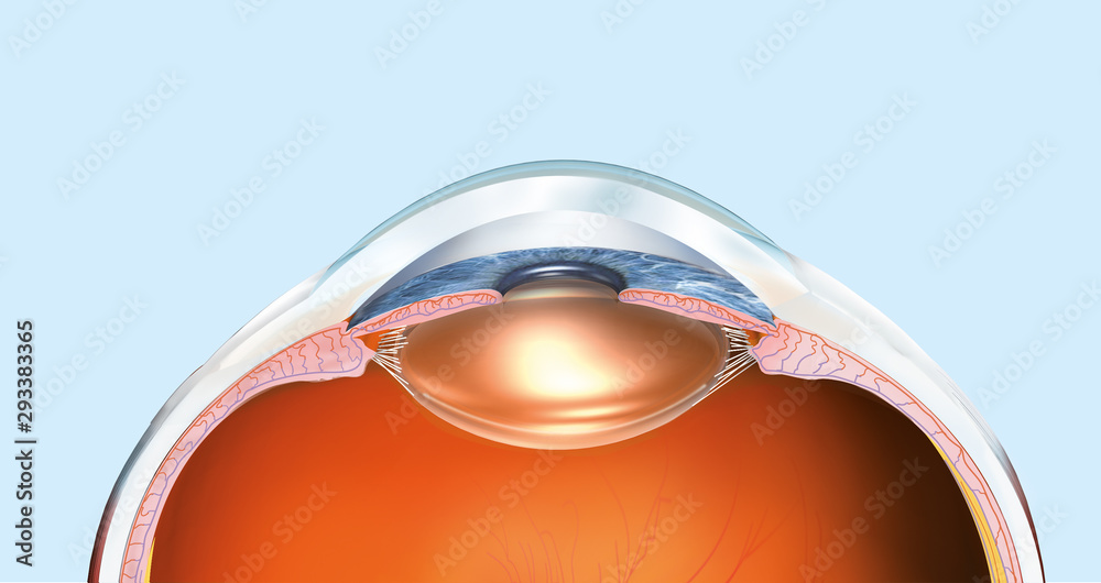 Human eye with artificial lens, labeled, medically 3D illustration Stock Illustration | Adobe Stock