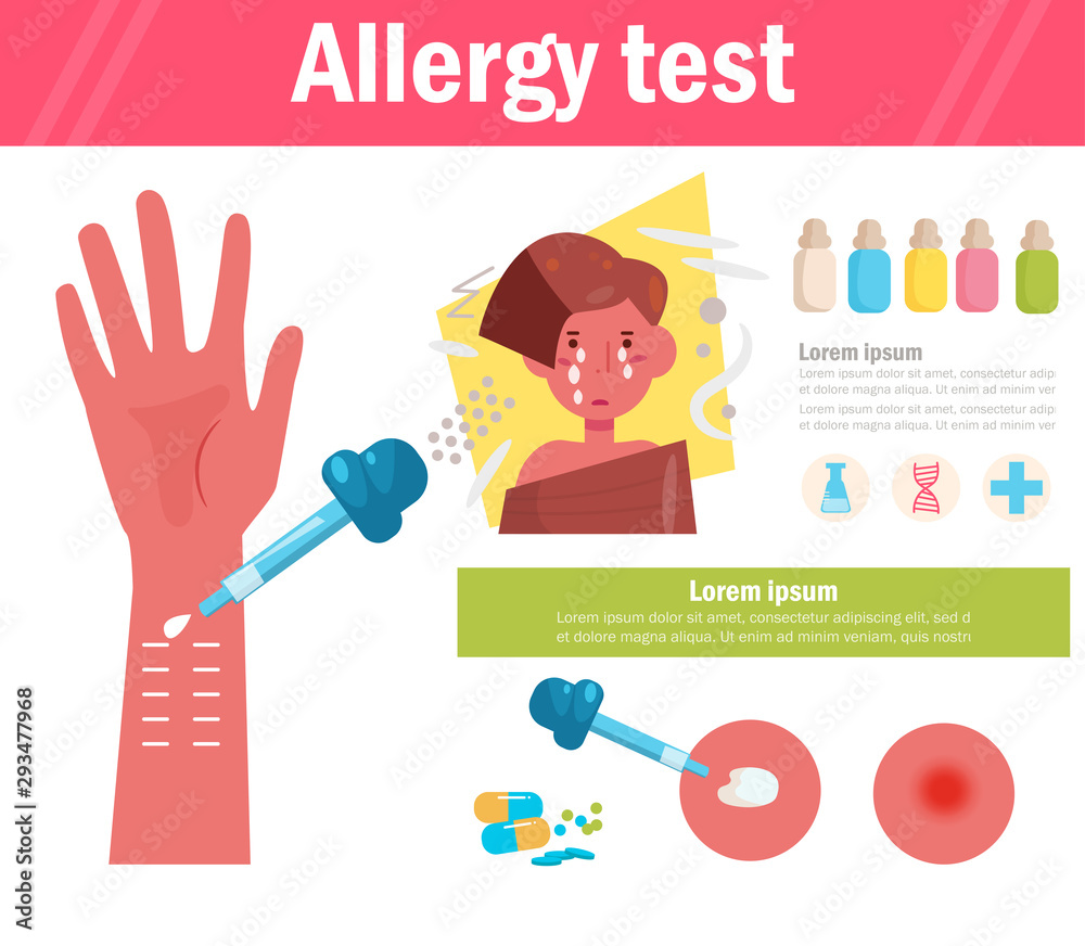 Allergy test Vector. Cartoon. Isolated art on white background. Flat ...