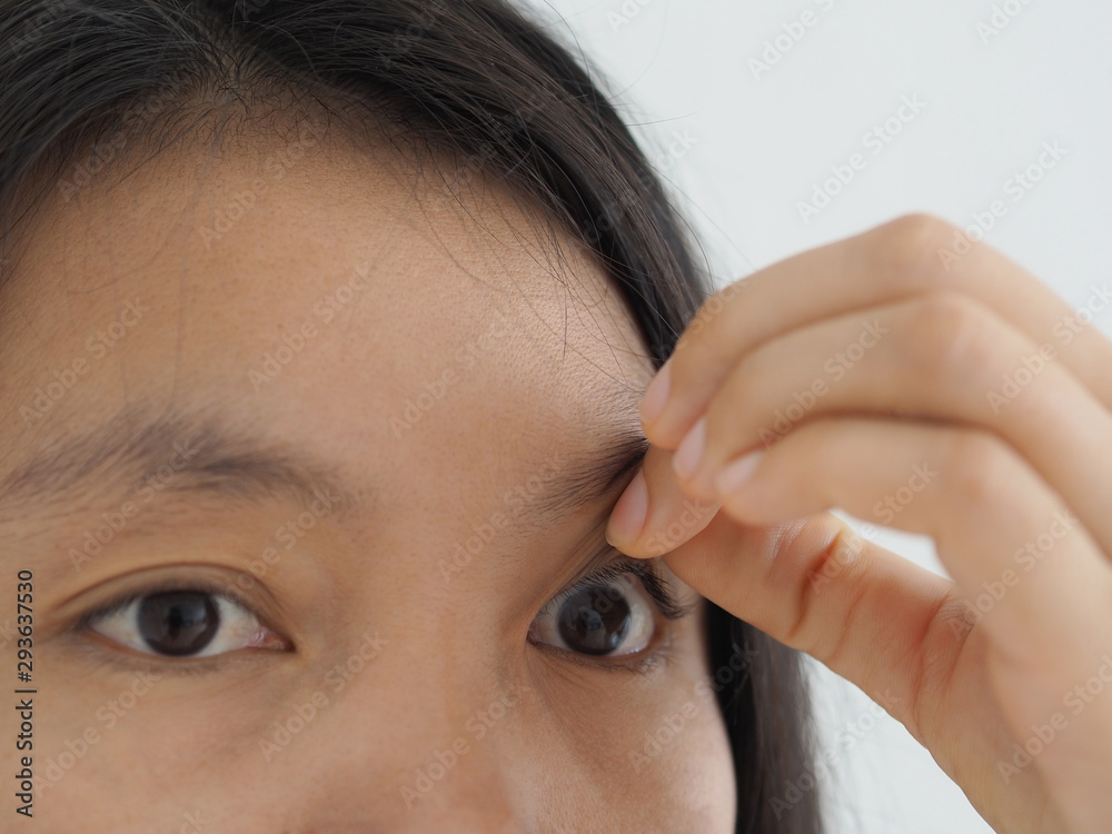 macular pucker and retinal detachment in woman, symptoms is vision is ...