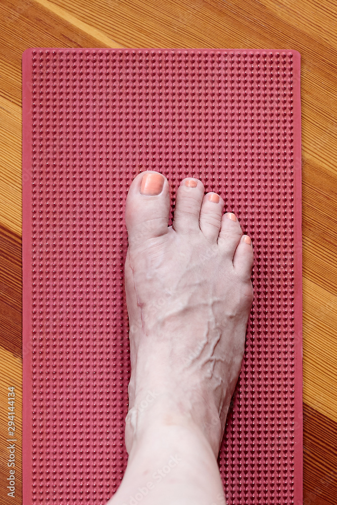 Woman right leg with pedicure and scar after traume on the needle ...