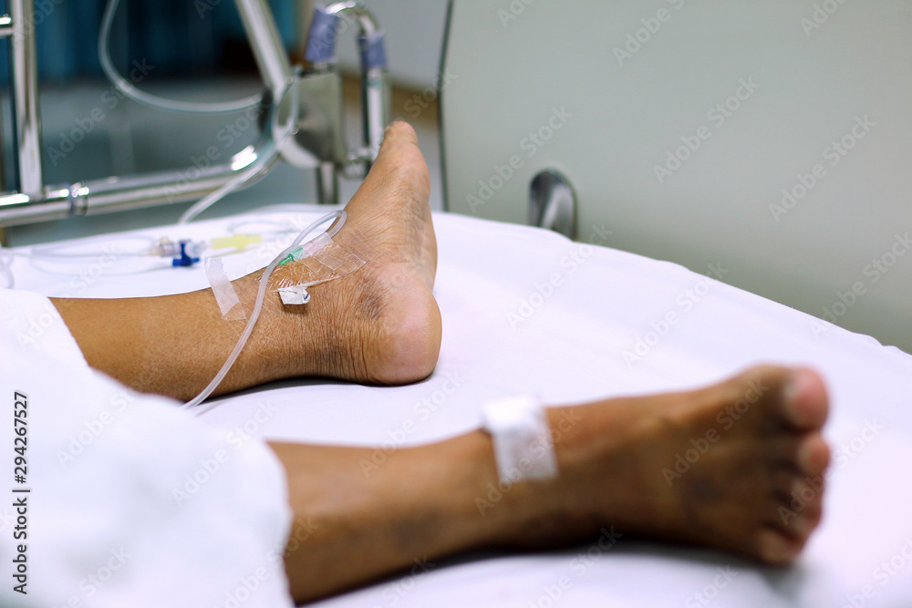 Old man with intravenous saline at the feet of the elderly patients at ...