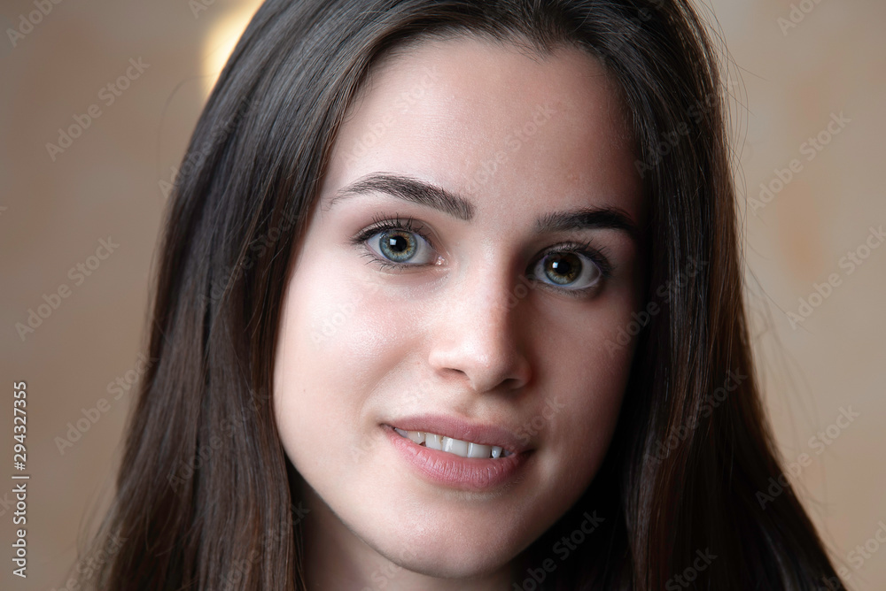 Beautiful girl with traits of heterochromia, a mosaicism that makes the ...