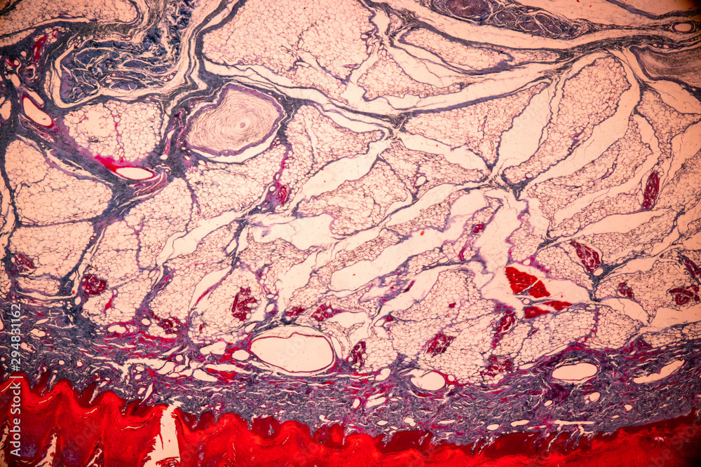 Education anatomy and Histological sample Touch corpuscles in skin ...