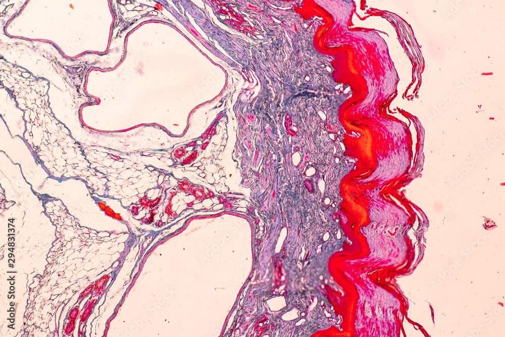 Education anatomy and Histological sample Touch corpuscles in skin ...