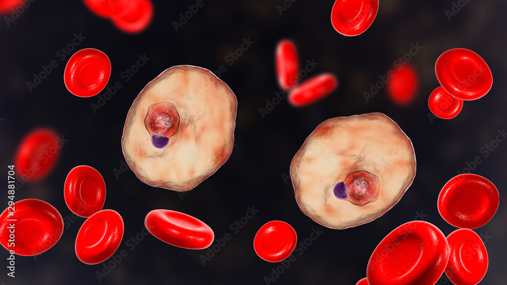 The malaria-infected red blood cell. 3D illustration showing malaria ...