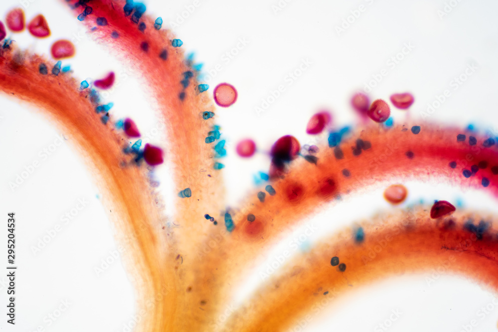 Poster Pollen grain is a microscopic body that contains the male ...