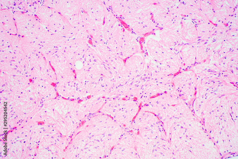 Pituitary gland anatomy under microscope for education pathology. Stock ...